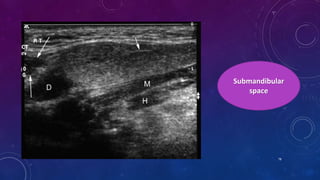 Ultrasonography - History, evolution and principles | PPTX