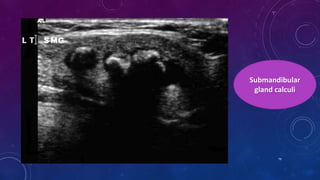 Ultrasonography - History, evolution and principles | PPTX