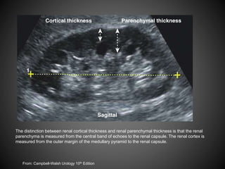 Urologic Ultrasonography | PPTX