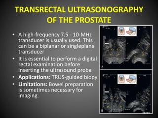 Urologic Ultrasonography | PPTX
