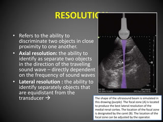 Urologic Ultrasonography | PPTX