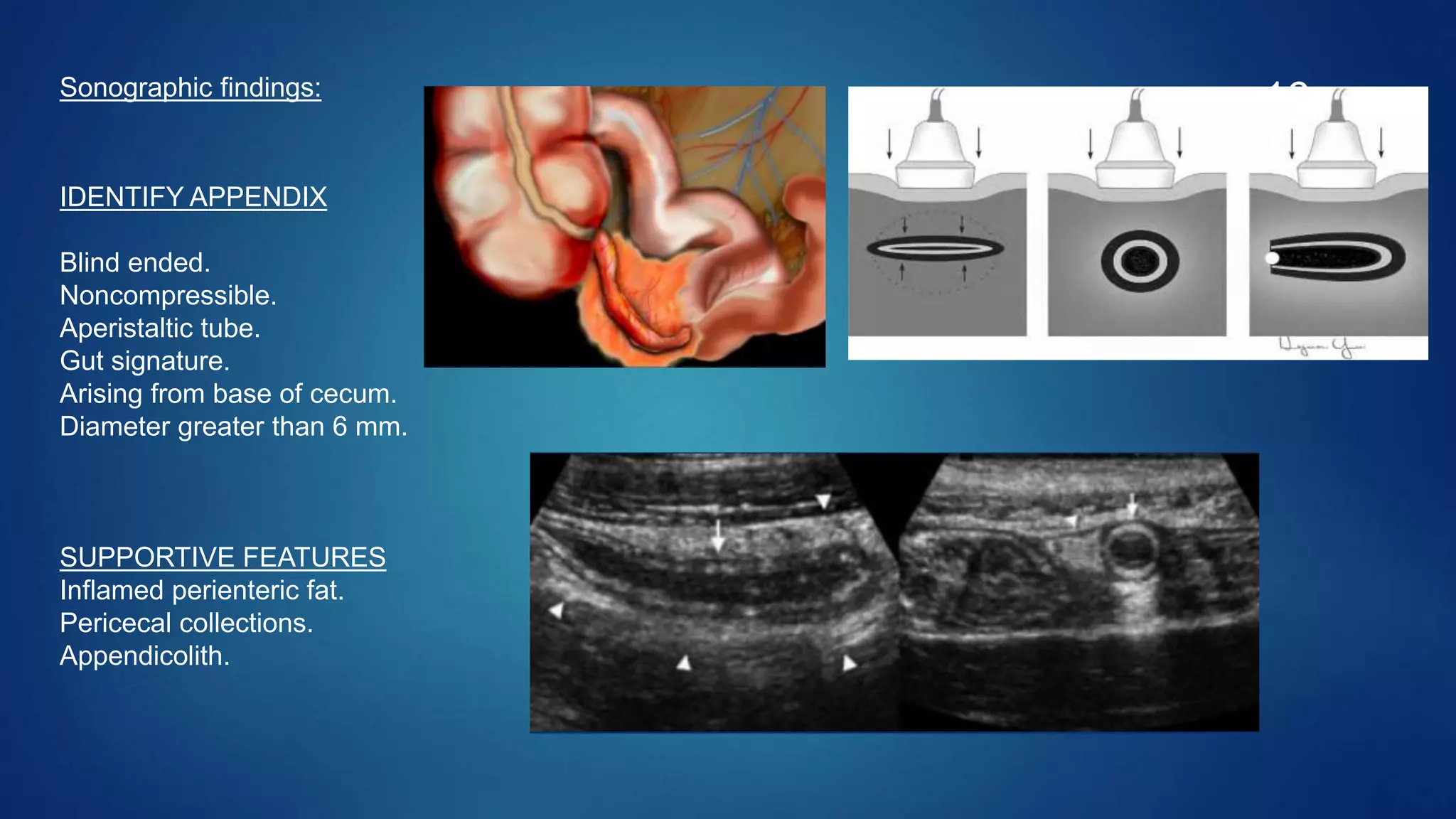 Ultrasonography in Acute Abdomen | PPTX