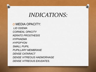 Ultrasonography of eye | PPTX