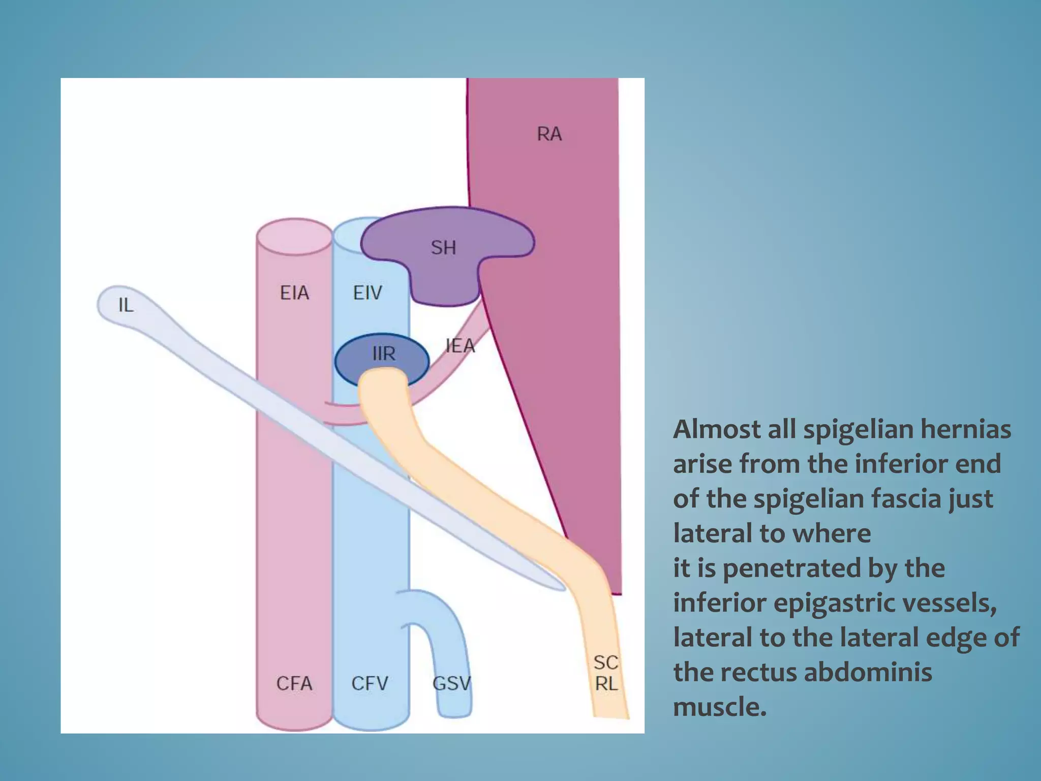 Ultrasoud hernia | PPTX