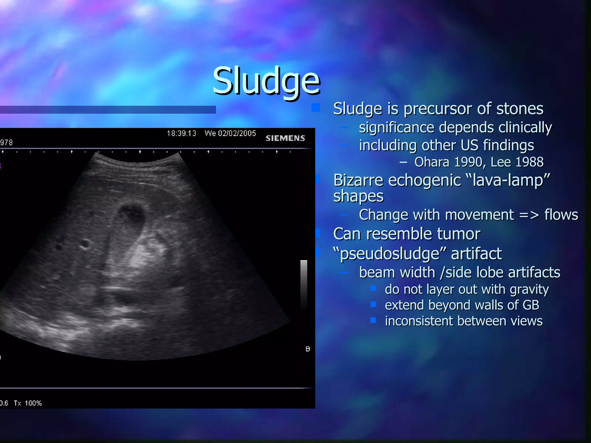 Ultrasound | PPT