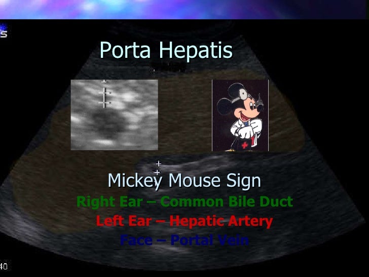 Ultrasound