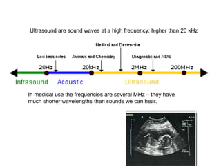 Ultrasound | PPTX