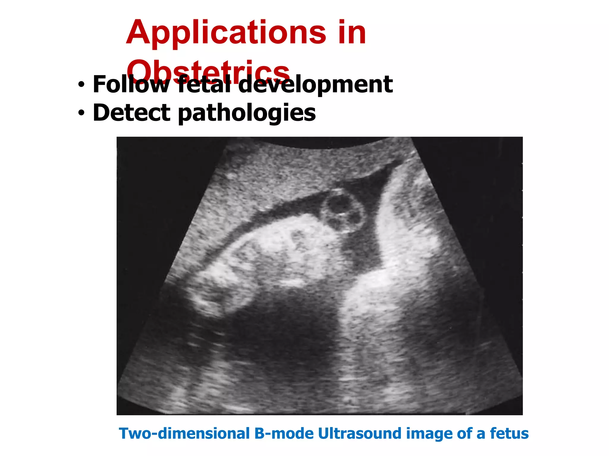 Ultrasound | PPTX