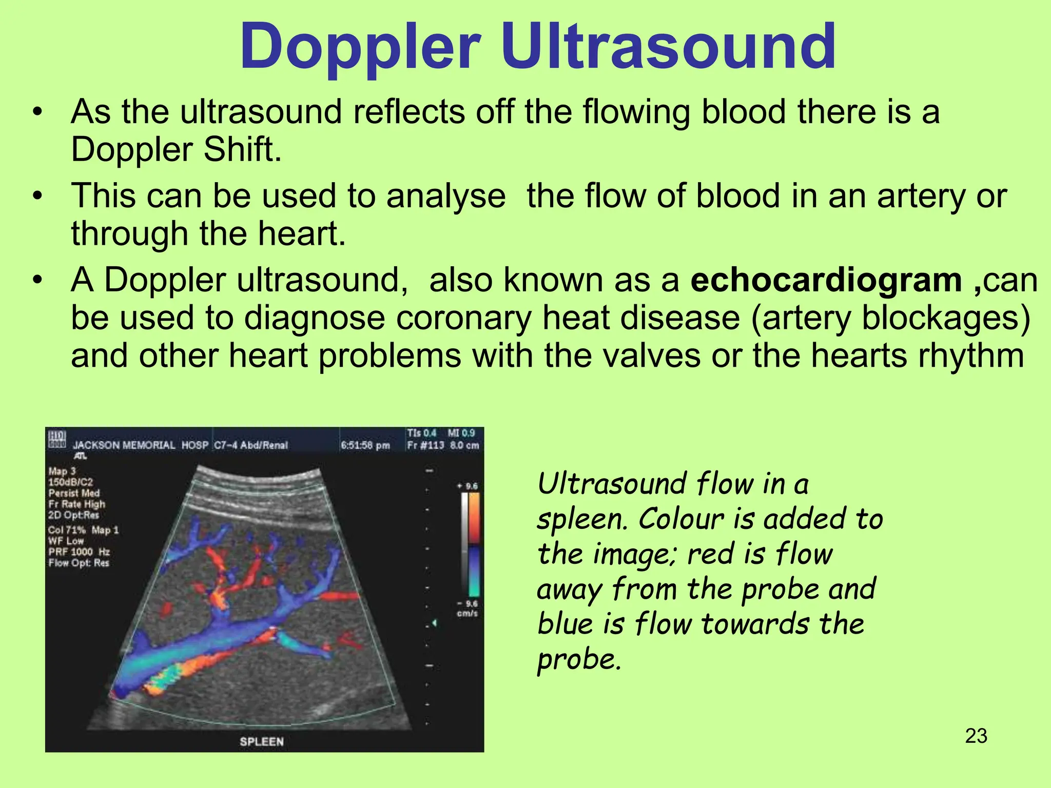 Ultrasound powerpoint presentation radio | PPT