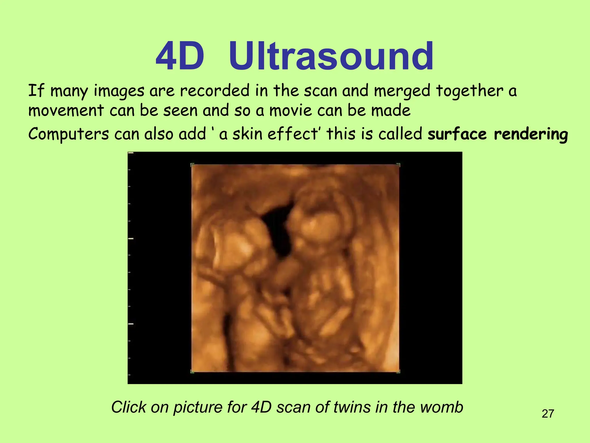 Ultrasound powerpoint presentation radio | PPT