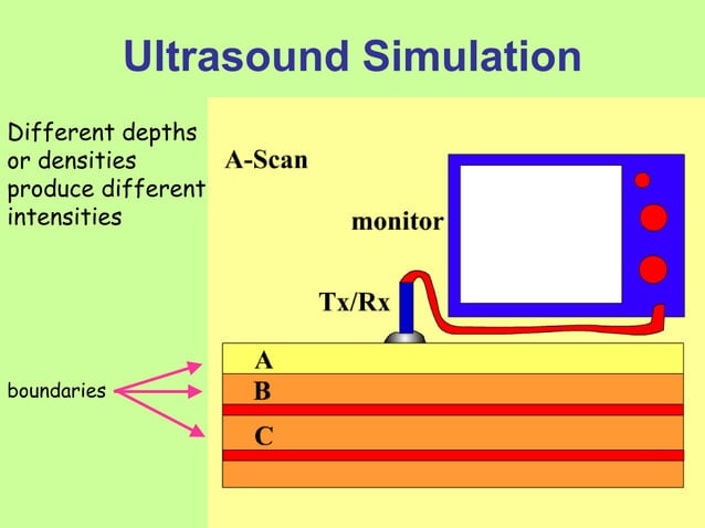 Ultrasound powerpoint presentation radio | PPT