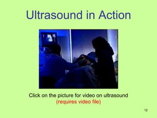 Ultrasound powerpoint presentation radio | PPT