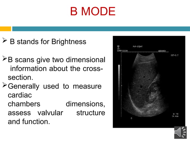 Basics of Ultrasound The sound above Human audible range.pptx