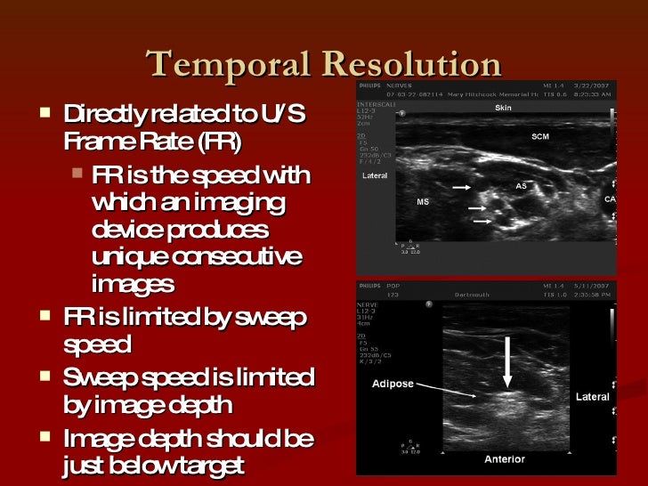Ultrasound And Regional Anesthesia Feb 2009
