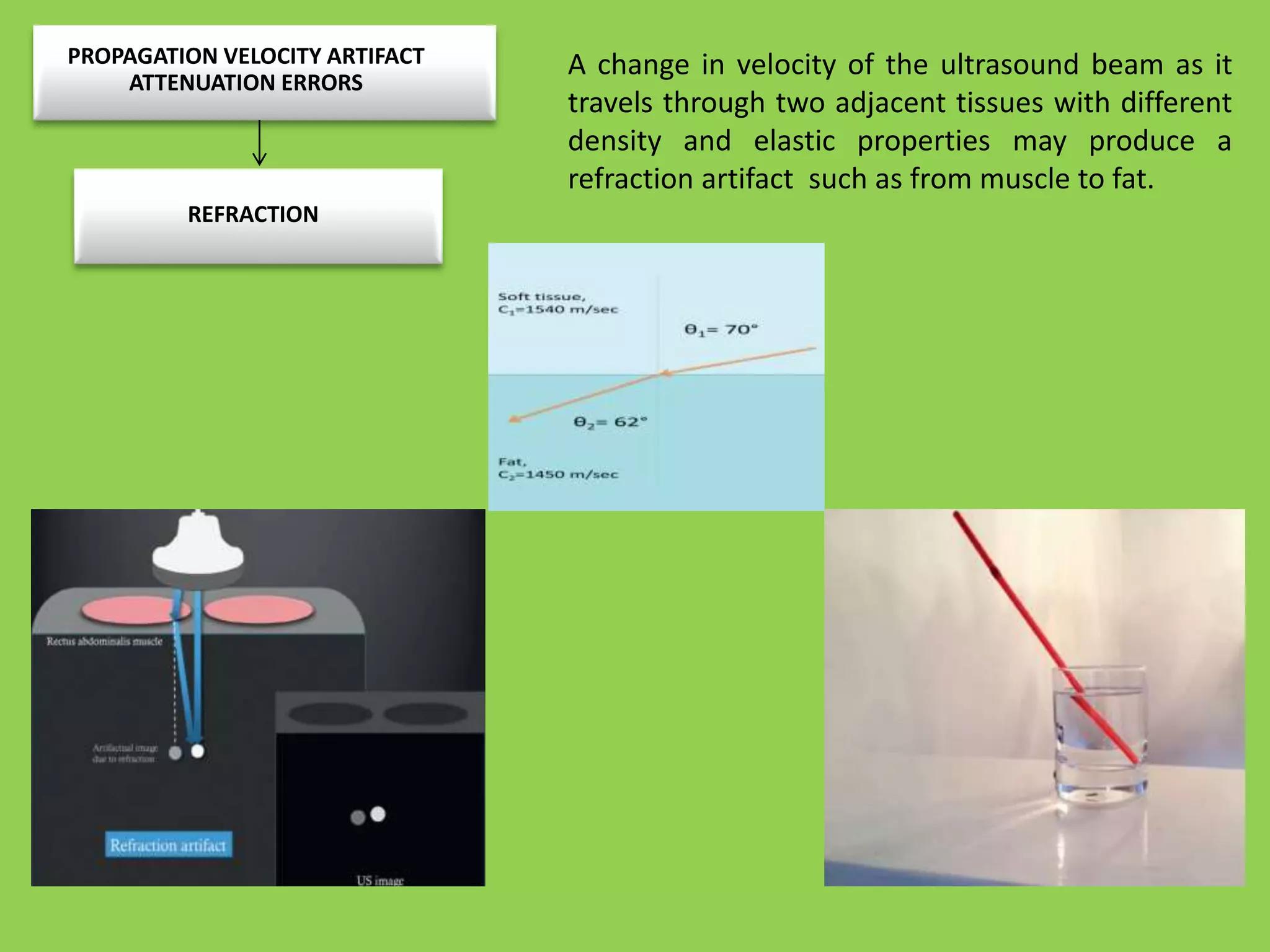 ULTRASOUND - ARTIFACTS.pptx