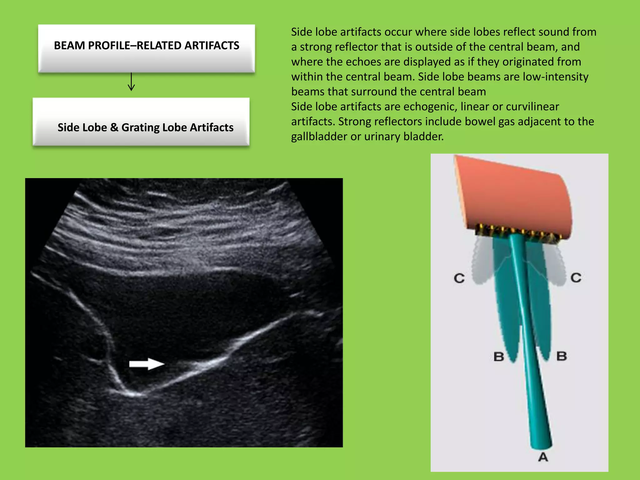 ULTRASOUND - ARTIFACTS.pptx