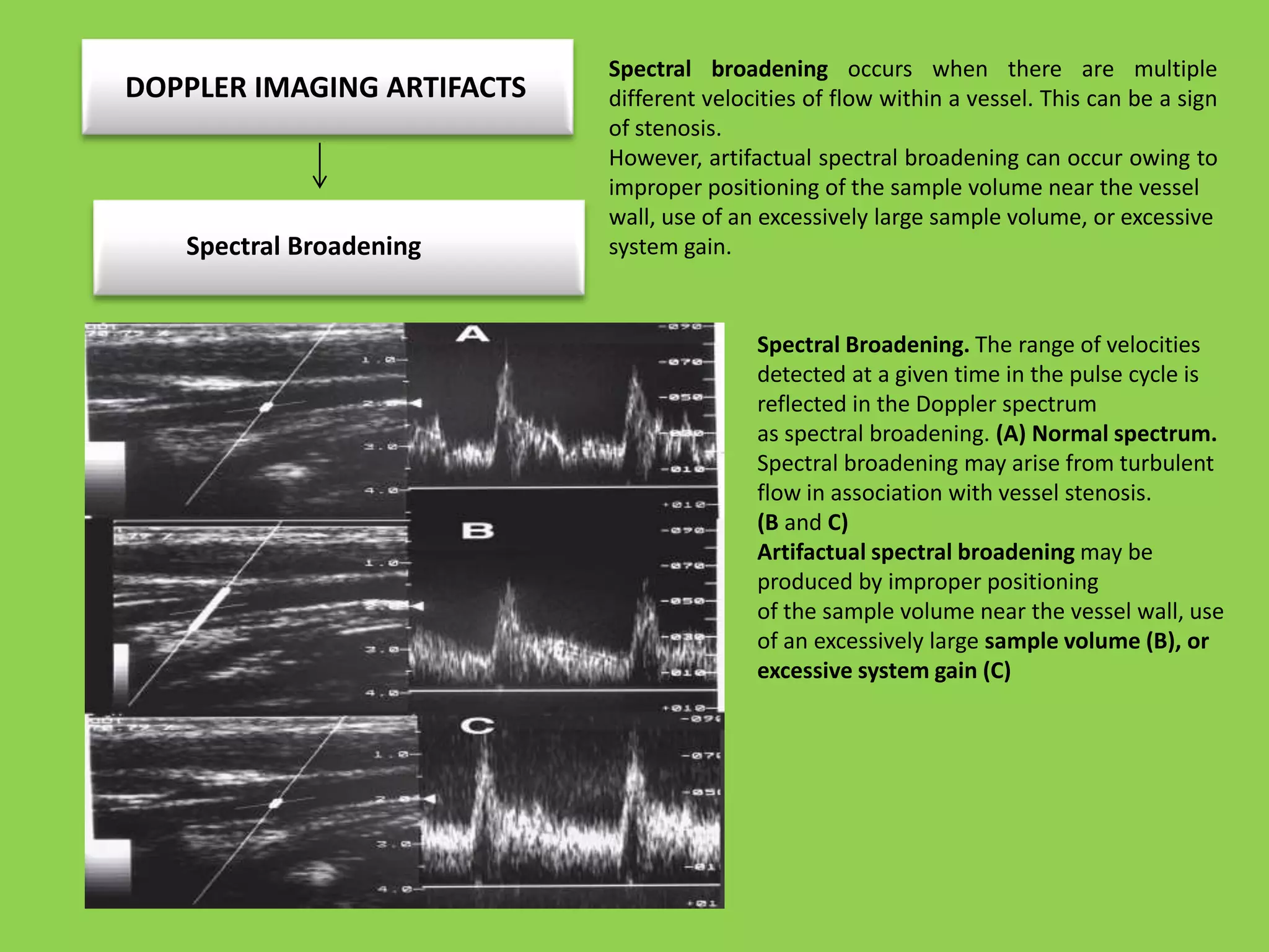 ULTRASOUND - ARTIFACTS.pptx