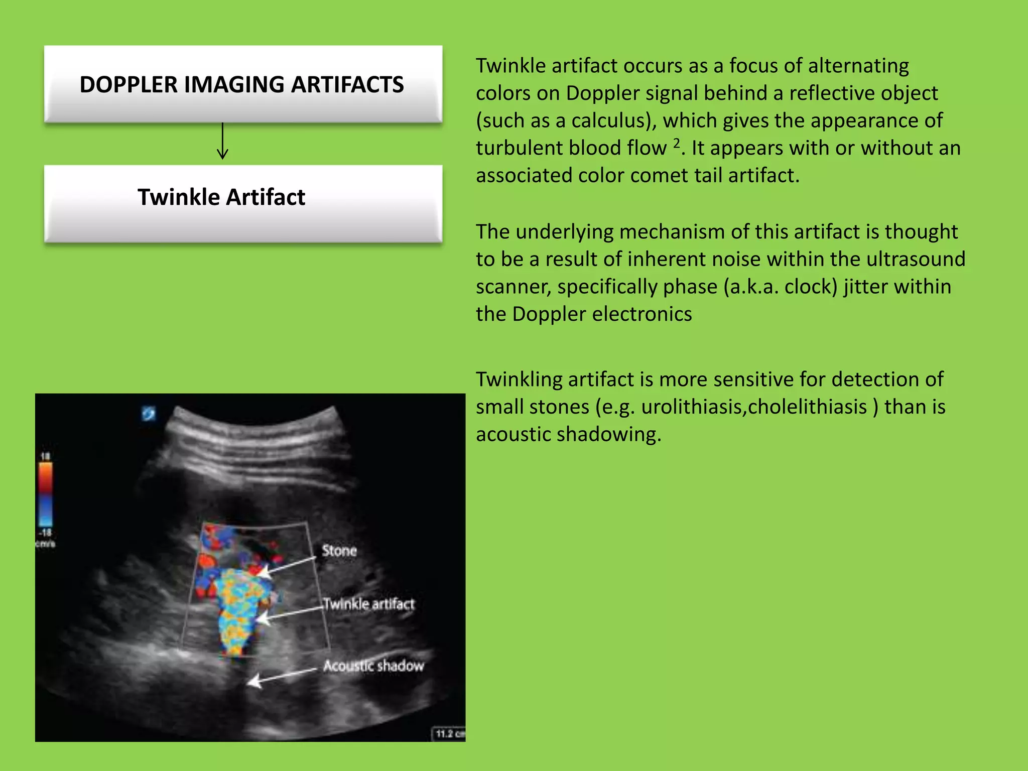ULTRASOUND - ARTIFACTS.pptx