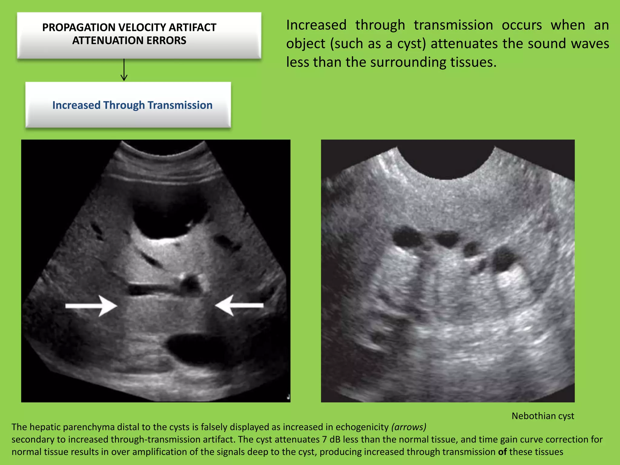 ULTRASOUND - ARTIFACTS.pptx
