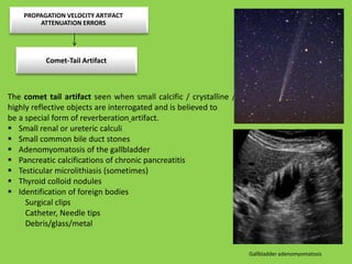 ULTRASOUND - ARTIFACTS.pptx