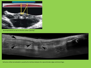 ULTRASOUND - ARTIFACTS.pptx