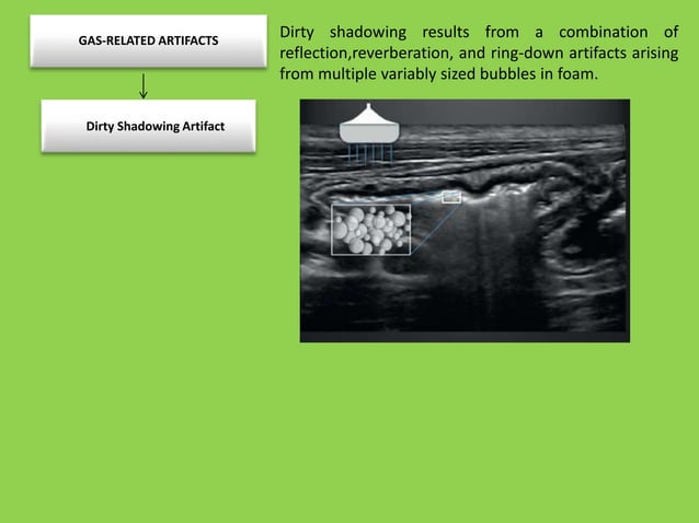 ULTRASOUND - ARTIFACTS.pptx | Medical Health