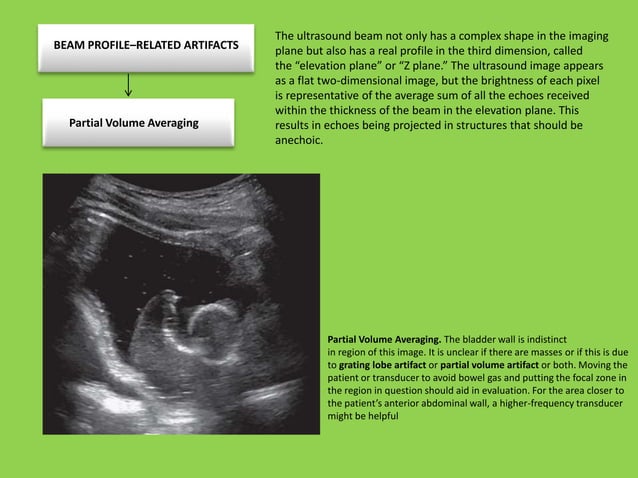 ULTRASOUND - ARTIFACTS.pptx | Medical Health