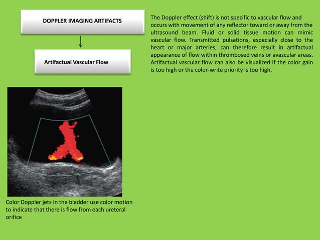 ULTRASOUND - ARTIFACTS.pptx | Medical Health