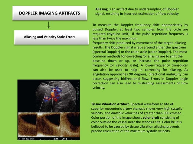 ULTRASOUND - ARTIFACTS.pptx | Medical Health