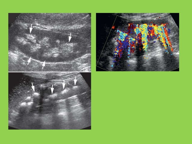 ULTRASOUND - ARTIFACTS.pptx | Medical Health