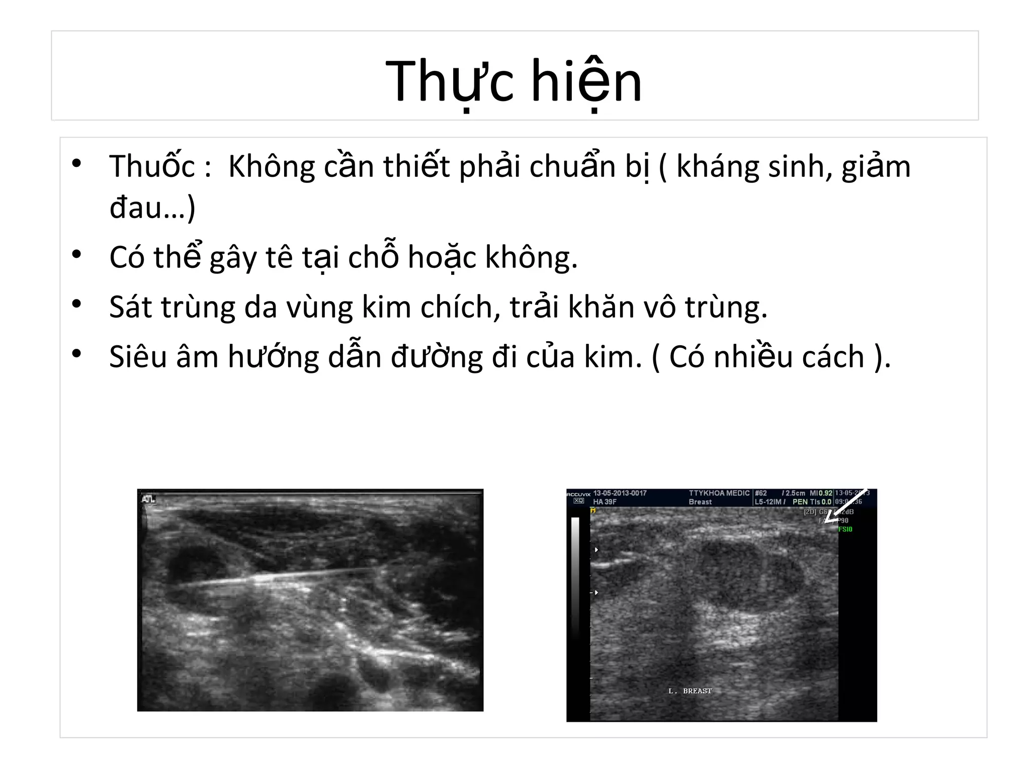 Ultrasound-Guided Breast FNAC | PPT