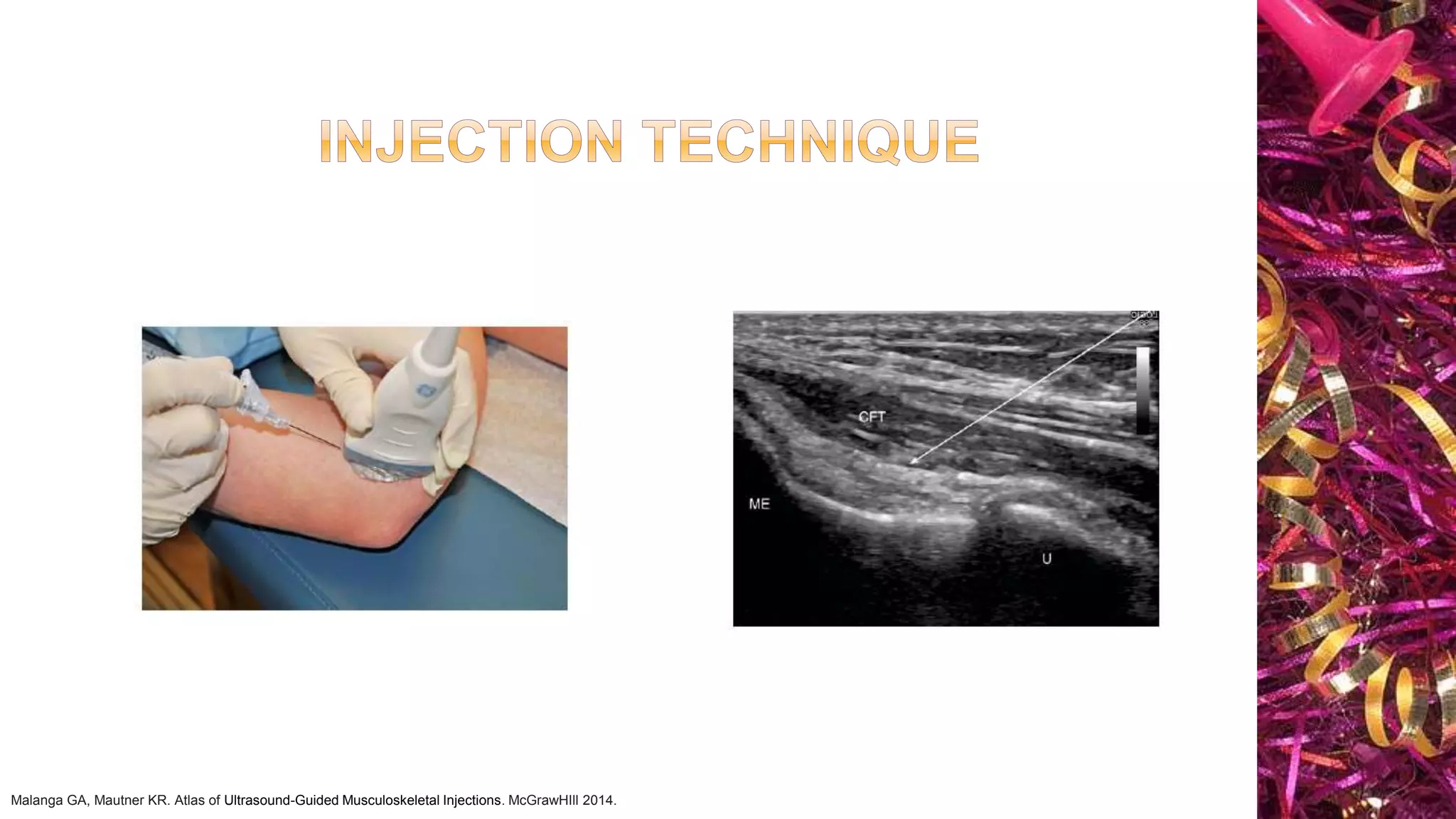 Ultrasound Guided Elbow Injections | PPTX