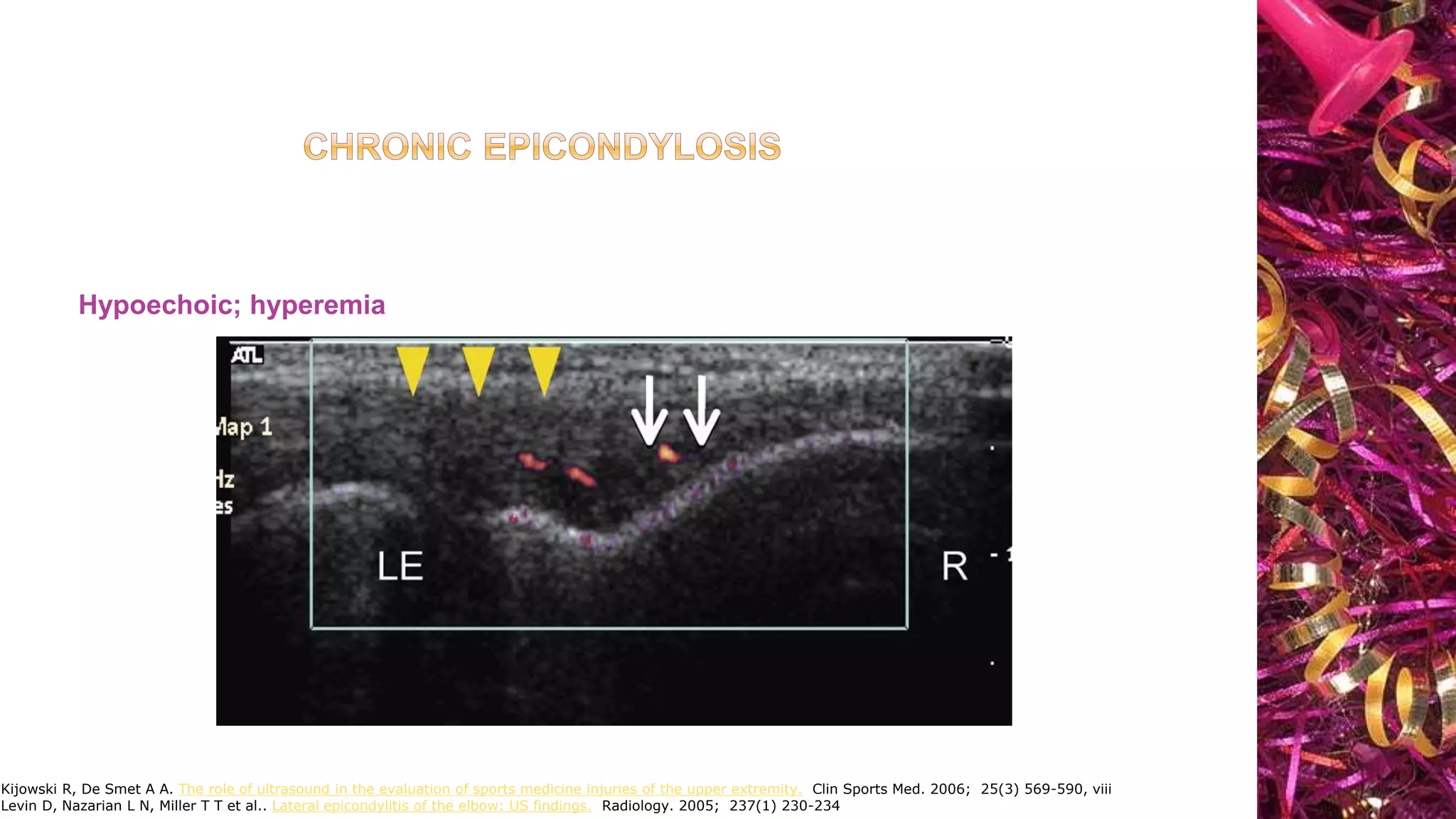 Ultrasound Guided Elbow Injections | PPTX