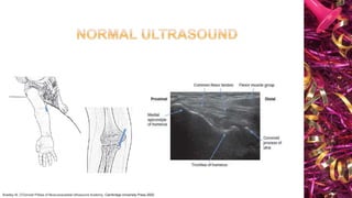 Ultrasound Guided Elbow Injections | PPTX