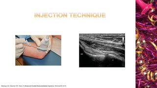 Ultrasound Guided Elbow Injections | PPTX