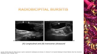 Ultrasound Guided Elbow Injections | PPTX