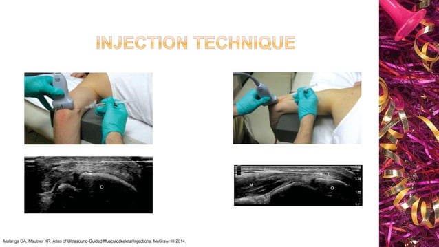 Ultrasound Guided Elbow Injections | PPTX | Death, Injury, or Military ...