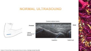Ultrasound Guided Elbow Injections | PPTX