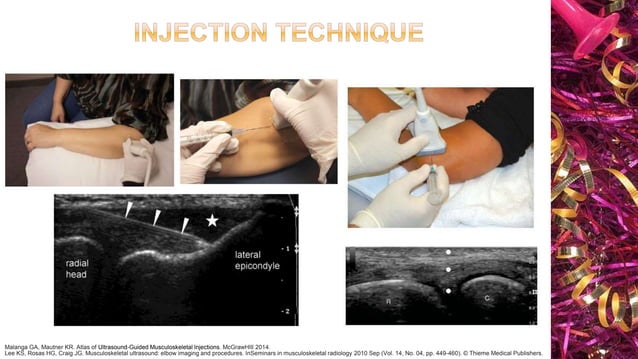 Ultrasound Guided Elbow Injections | PPTX | Death, Injury, or Military ...