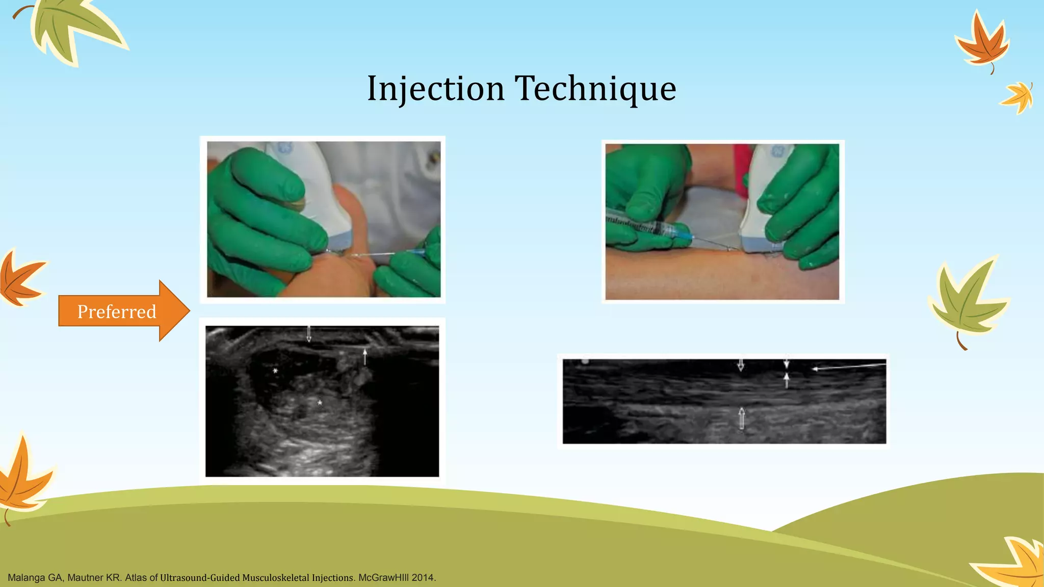 Ultrasound Guided Foot and Ankle Injections | PPT