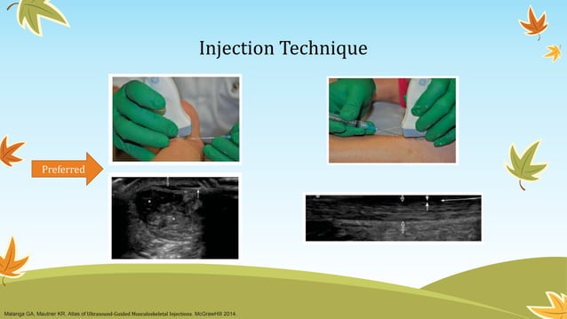 Ultrasound Guided Foot and Ankle Injections | PPT