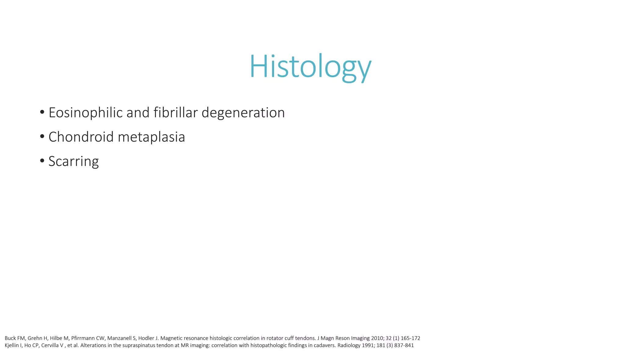 Ultrasound-Guided Percutaneous Tenotomy | PPTX