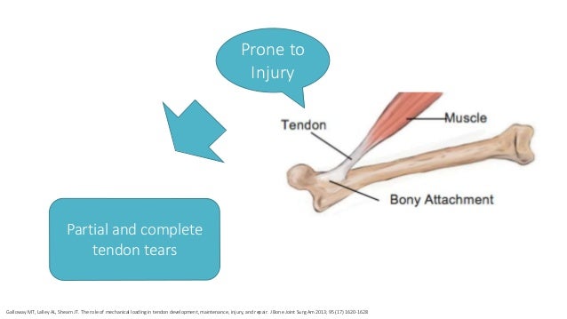 Ultrasound-Guided Percutaneous Tenotomy