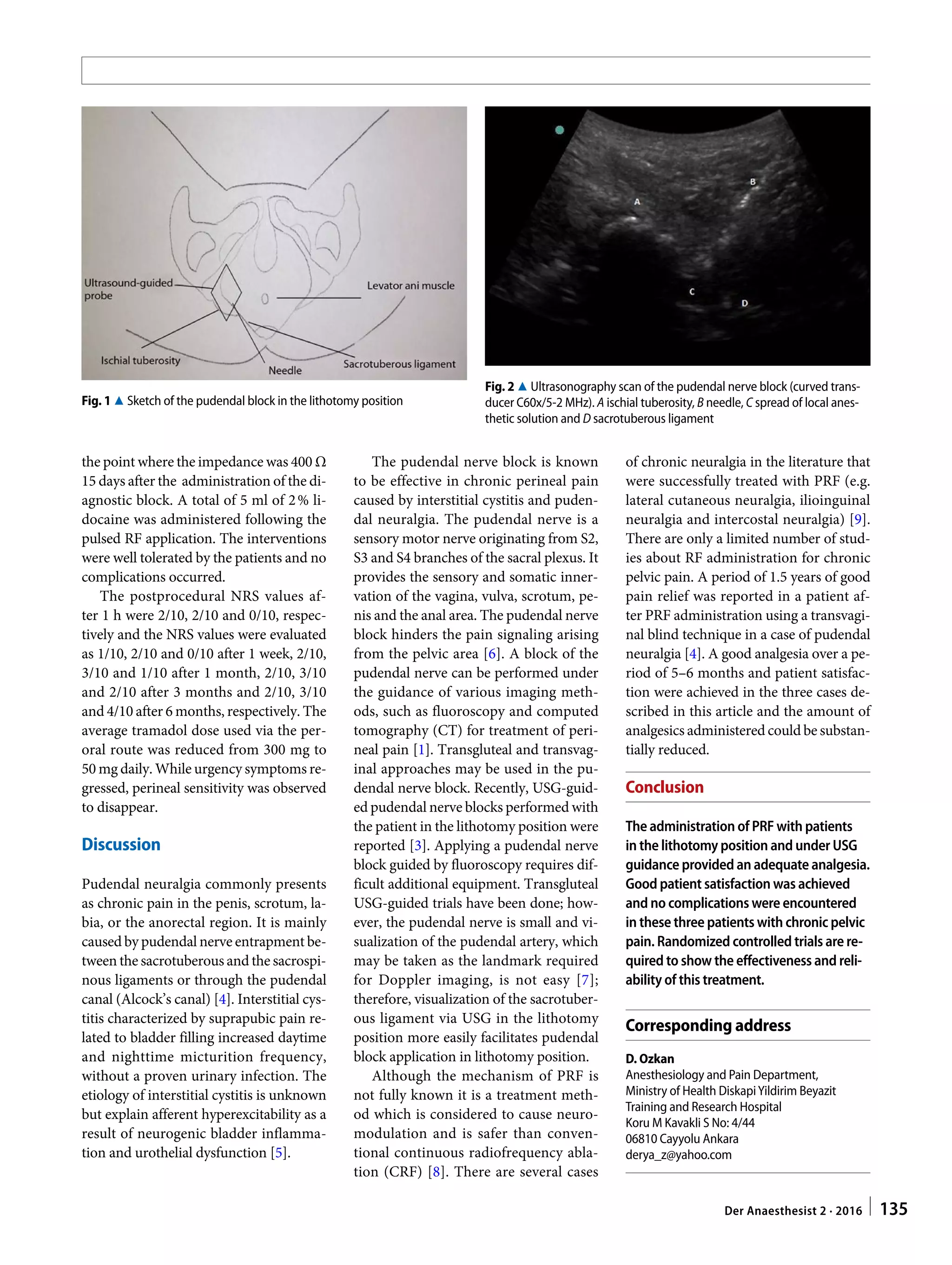 Ultrasound guided pulsed radiofrequency treatment of the pudendal nerve in chronic pelvic pain | PDF