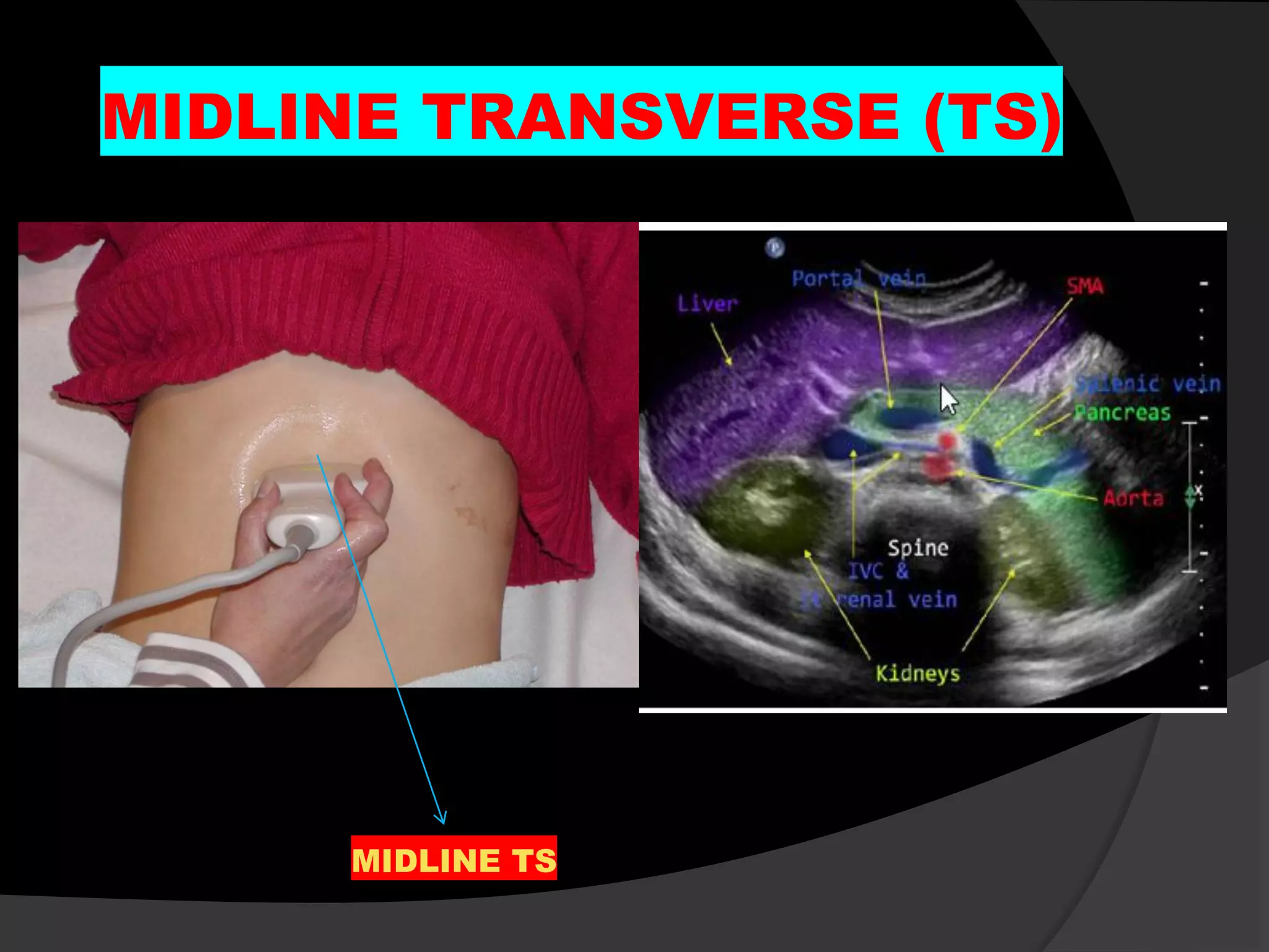 How to do Liver Ultrasound | PDF