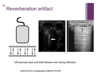 Ultrasound | PPTX