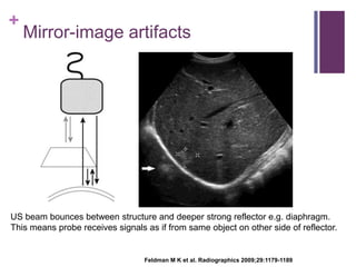 Ultrasound | PPTX