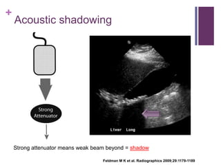Ultrasound | PPTX