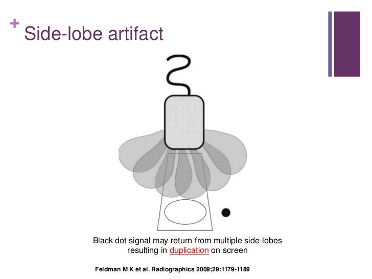 Artifact - Slid Lobe artifact: slide and grating lobe : 네이버 블로그