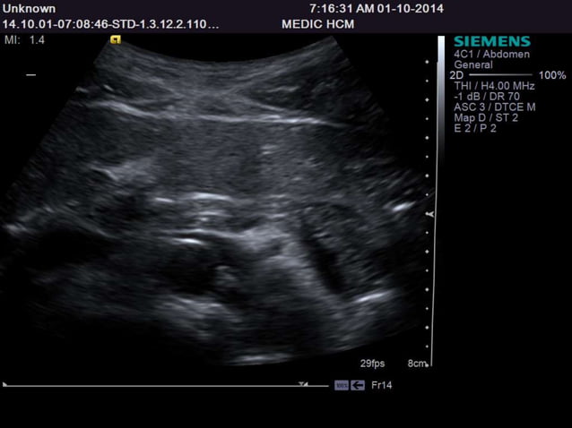 Ultrasound Anatomy for 1st- and 2nd- year Medical Students of Tan Tao ...